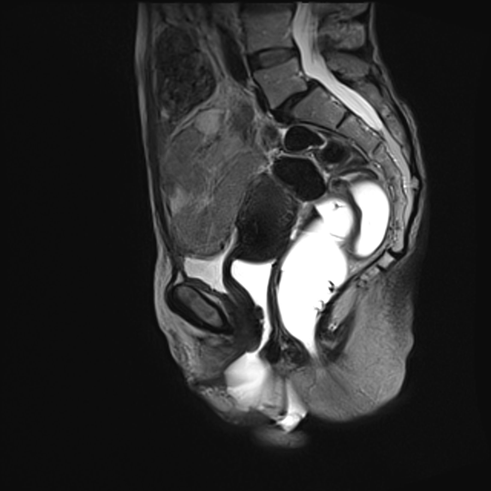 Imagerie gynécologique - Radiologie Corinne Bordonne